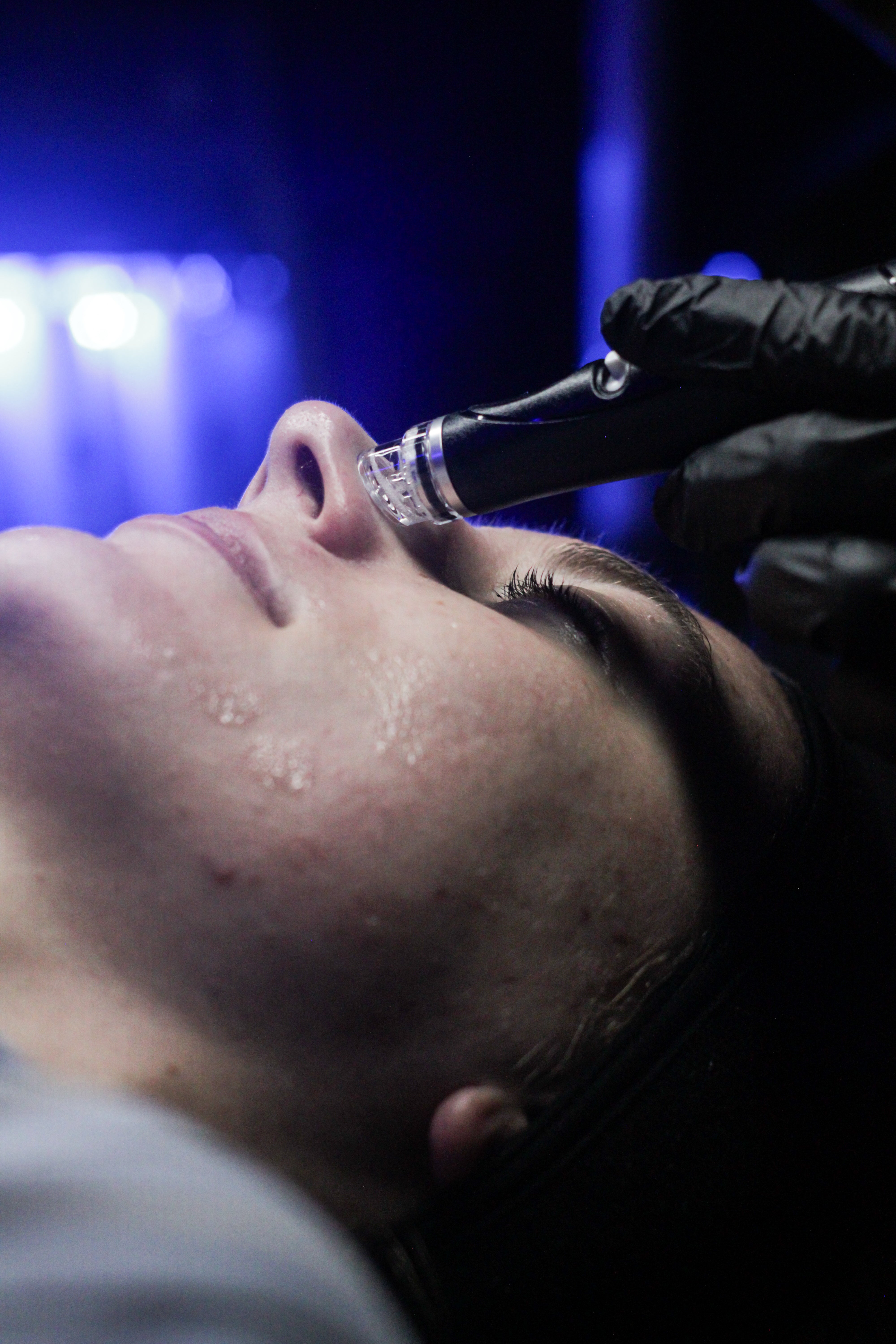 HydraFacial Package – Dezthetics Skincare Studio